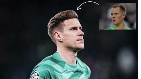 Ter Stegen Hair Transplant Journey - CLINIQUEPLUS